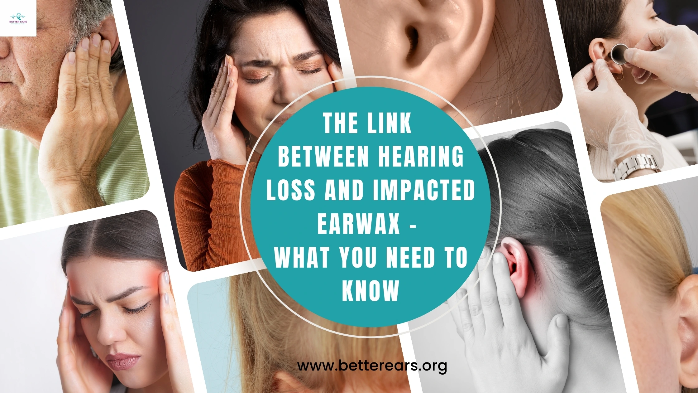 The Link Between Hearing Loss and Impacted Earwax – What You Need to ...